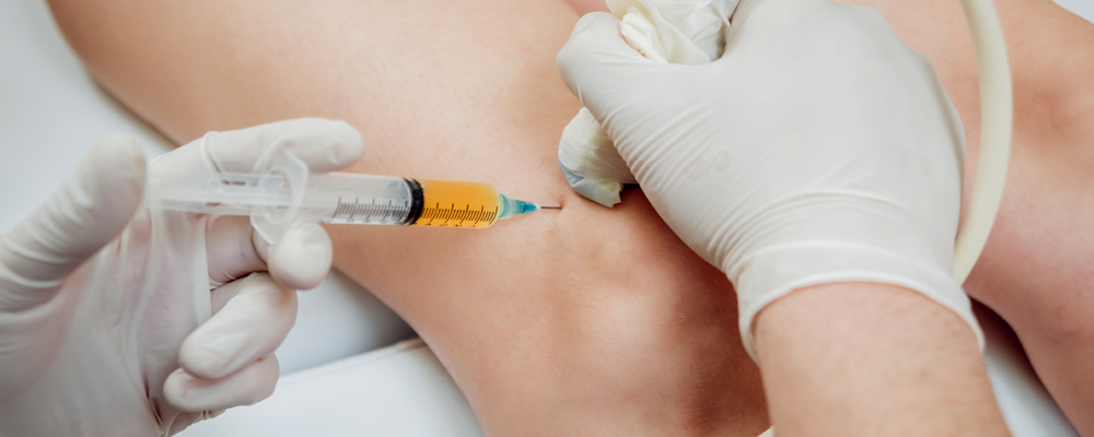 Platelet-Rich Plasma (PRP) Injections | Qscan